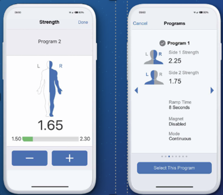 Abbott's Infinity™ Deep Brain Stimulation System | Abbott